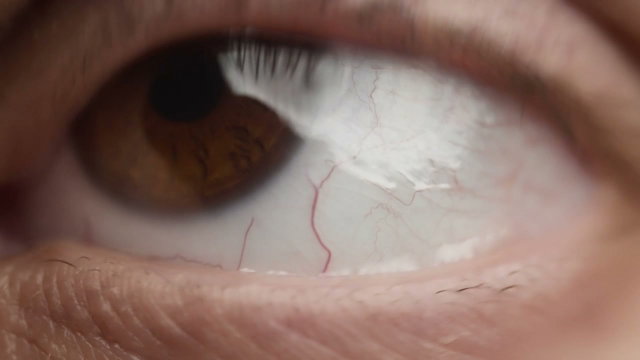 Extreme Close-up of a Human Eye Opening • Stock Video on Uppbeat